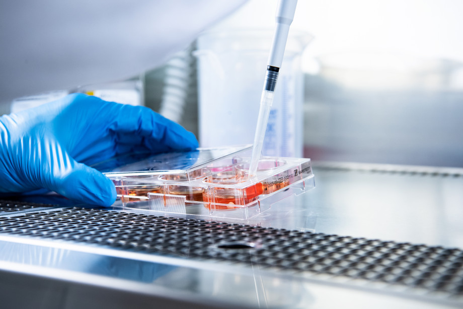 Skin cells from frontotemporal dementia patients may prove useful in ...